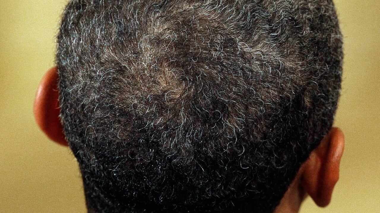 Nieuw bewijs verklaart waarom haren grijs worden door stress ...