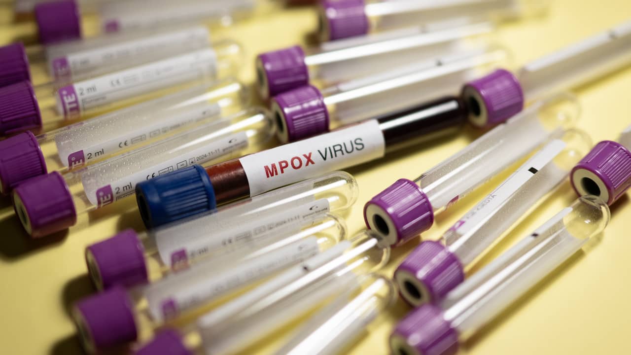 Nederlandse viroloog aangeklaagd in VS voor smokkelen flesjes met mpox ...