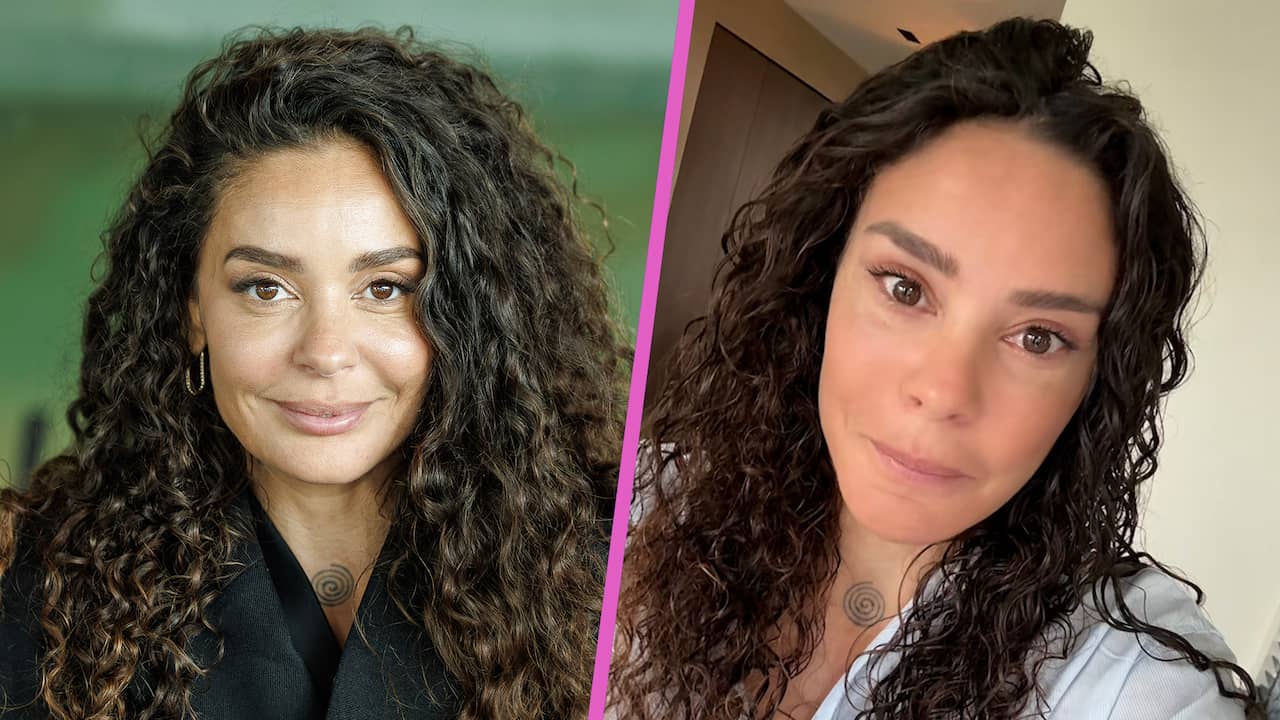 Fajah Lourens toont herstel na cosmetische ingrepen | NU.nl
