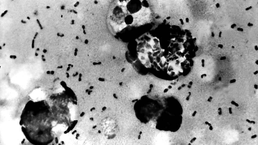 Vijf mensen op Madagaskar overleden aan longpest | Algemeen | NU.nl