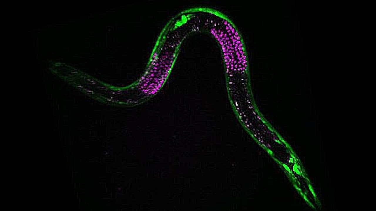 Dokters halen bijna 4 centimeter lange worm uit amandel van Japanse ...