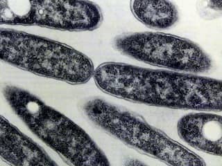 RIVM waarschuwt voor legionella in tuinslang | Gezondheid | NU.nl