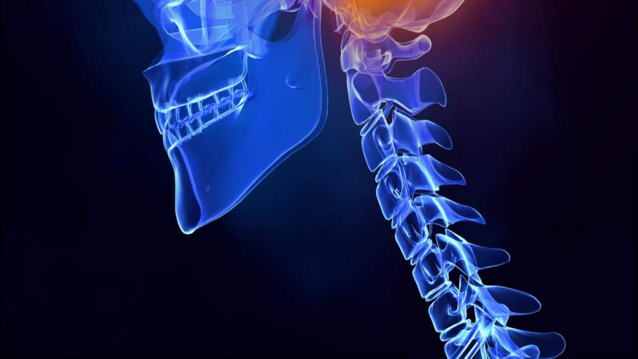 CT-scan bewijst effect behandeling erfelijk longemfyseem | Overig | NU.nl