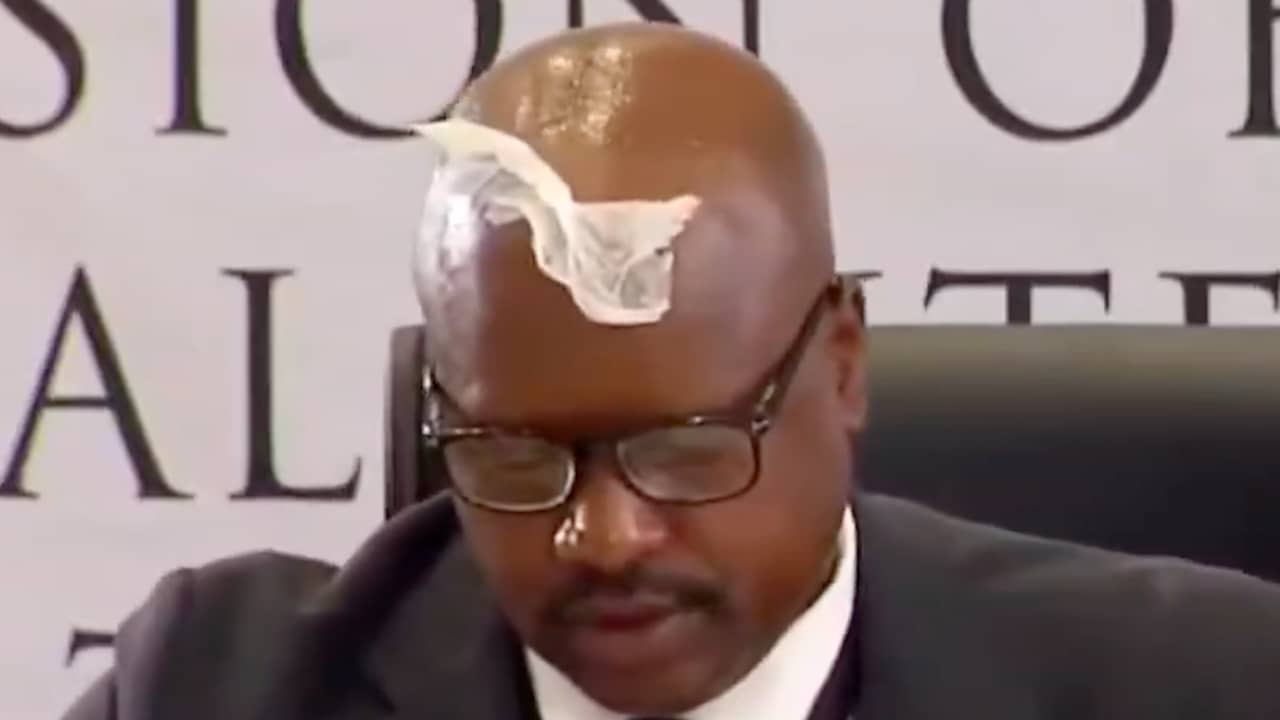 Tissue blijft plakken aan hoofd Zuid-Afrikaanse oud-politiechef tijdens ...