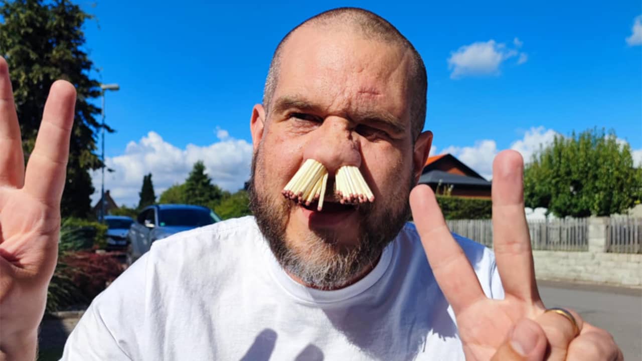 Zweedse man stopt 81 lucifers in zijn neus en vestigt wereldrecord ...