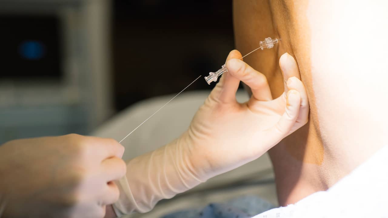 Ruggenprik, maar dan relaxter: 'Je kunt je onderlichaam nog voelen en ...