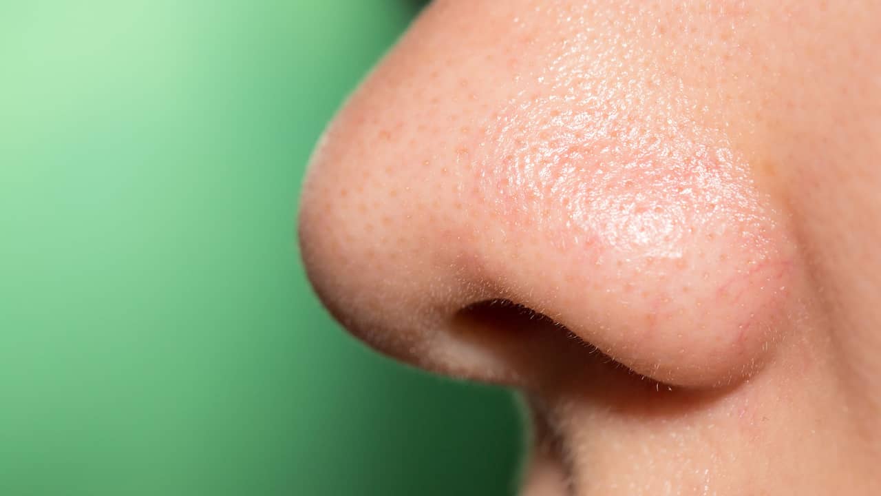 Puntje van de neus en jukbeenderen meest 'erfelijke' gezichtsonderdelen ...